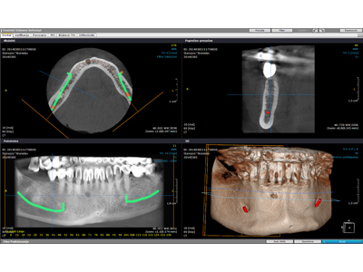 C ORTHOPAN DENTAL IMAGING | Radiology | 130 Cvijiceva st., Palilula ...
