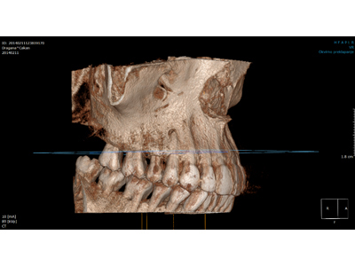 C ORTHOPAN DENTAL IMAGING | Radiology | 130 Cvijiceva st., Palilula ...