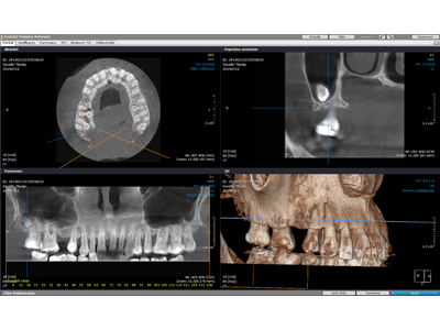 C ORTHOPAN DENTAL IMAGING | Radiology | 130 Cvijiceva st., Palilula ...