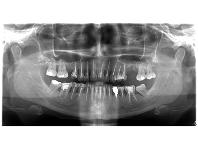 C ORTHOPAN DENTAL IMAGING | Radiology | 130 Cvijiceva st., Palilula ...